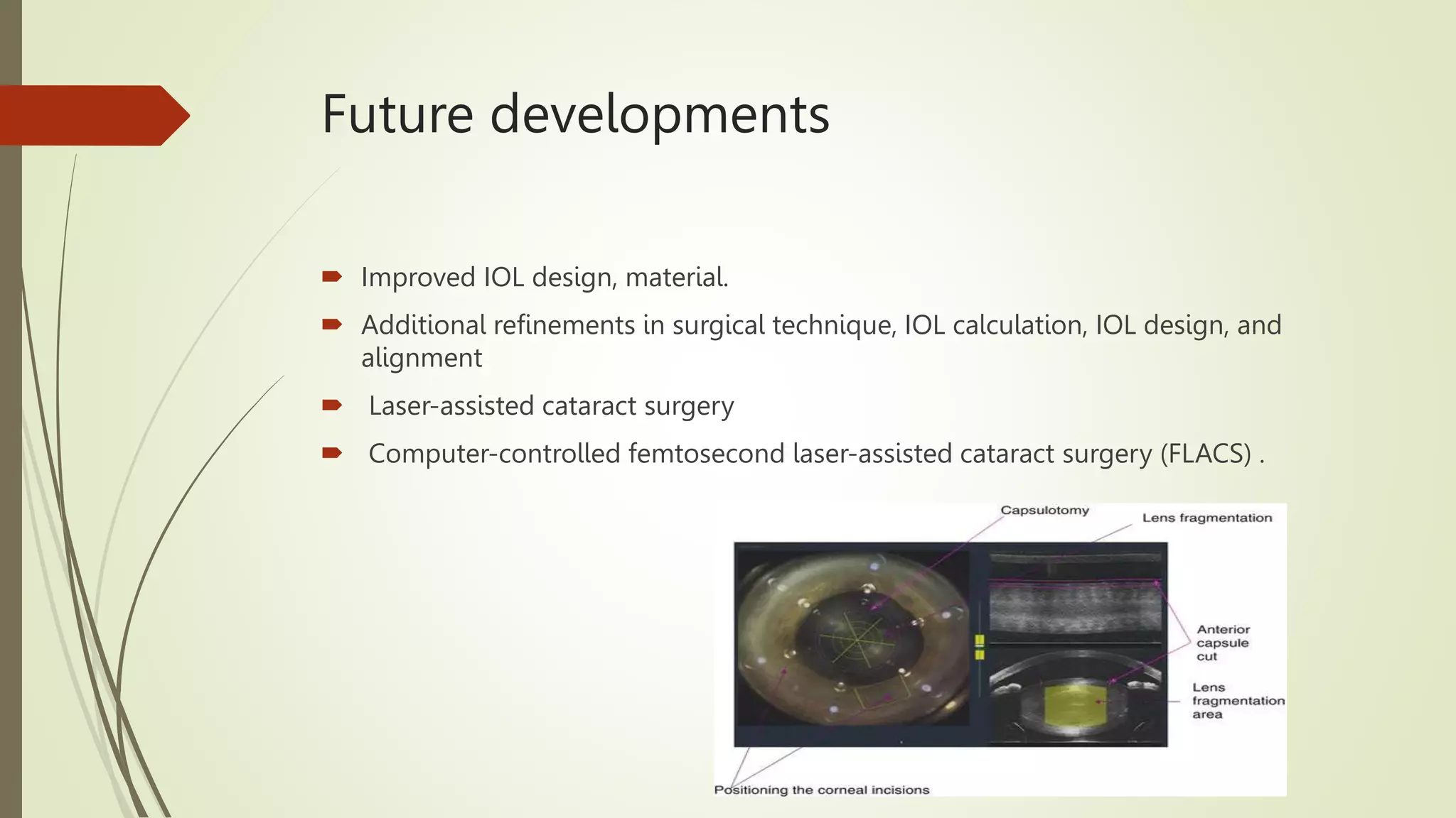 Premium intraocular lenses The past, present and-3.pptx