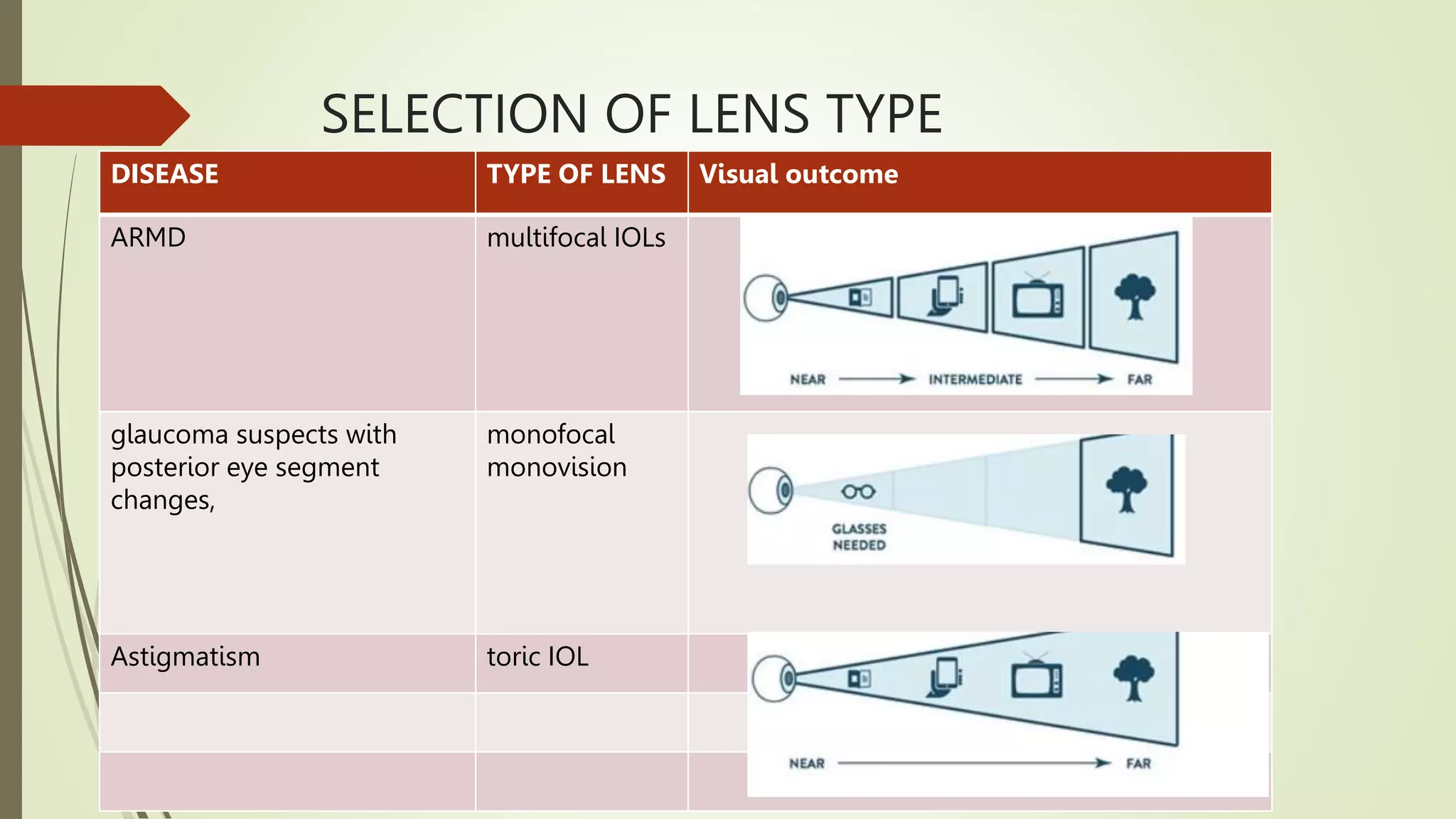 Premium intraocular lenses The past, present and-3.pptx