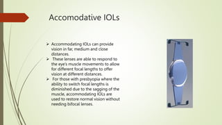 Premium intraocular lenses The past, present and-3.pptx