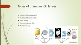 Premium intraocular lenses The past, present and-3.pptx | Eye and Vision Conditions | Diseases ...