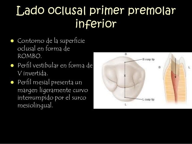 Premolares Inferiores