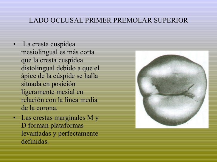 Premolares Superiores