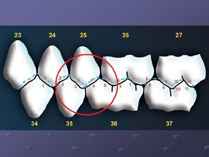 Premolares y olcusion en los permolares