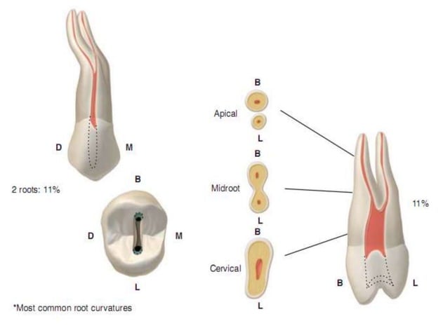 Anatomy of canines and premolars (ENDO) | PPSX