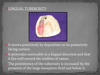 Prenatal and postnatal growth of mandible | PPTX
