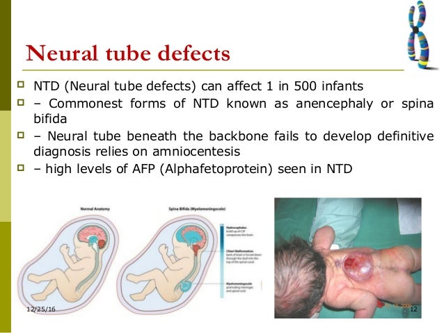 Prenatal cytogenetic