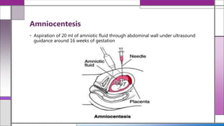 Prenatal Diagnosis | PPTX