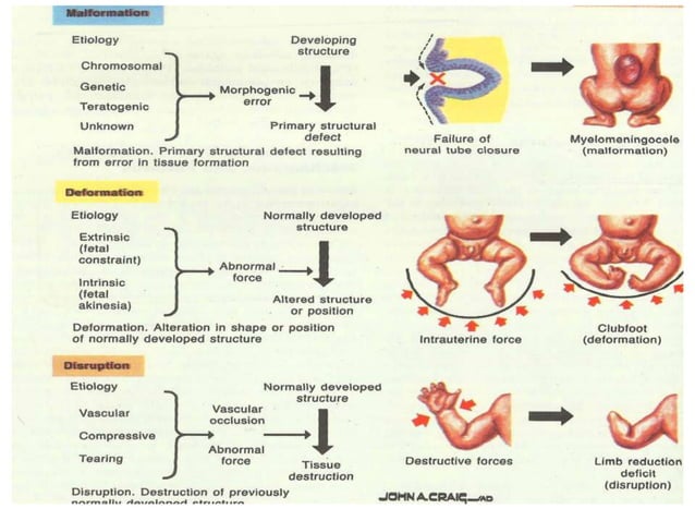 Prenatal diagnosis and fetal therapy | PPTX