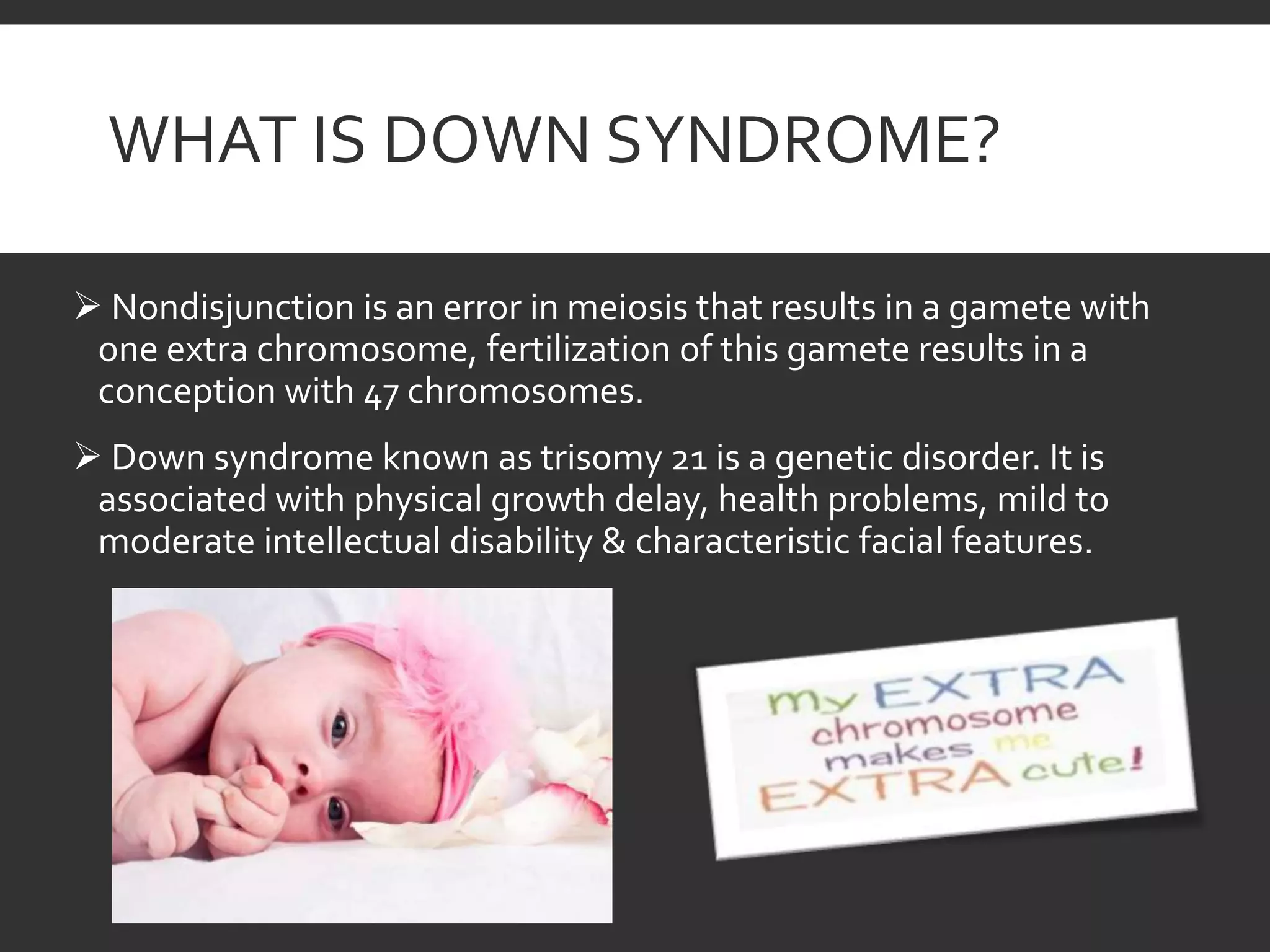 Prenatal diagnosis of down syndrome | PPTX