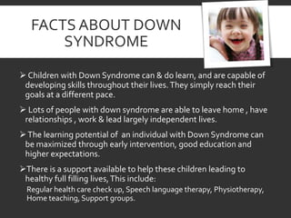 Prenatal diagnosis of down syndrome | PPTX