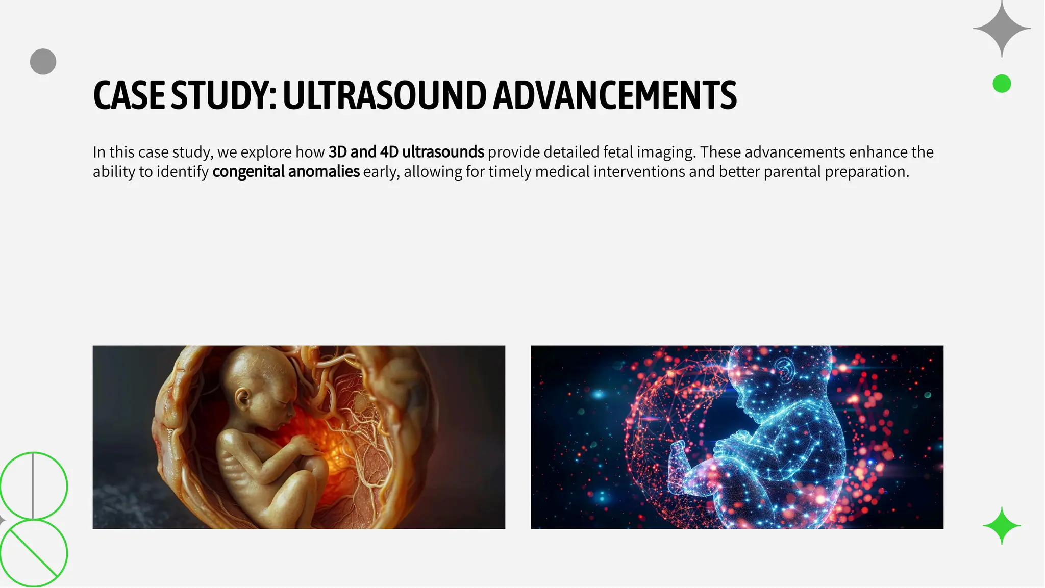 Prenatal diagnosis presentation case.pdf | Pregnancy | Reproductive Health