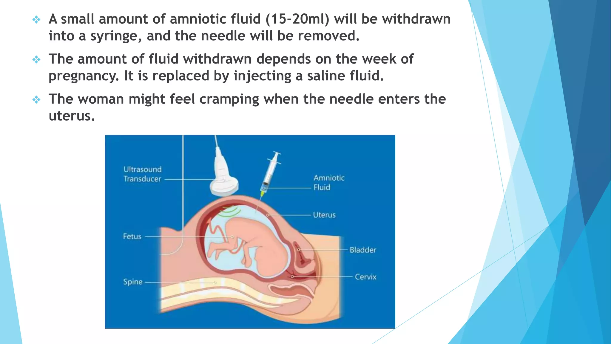 PRENATAL DIAGNOSIS TECHNIQUES.pptx