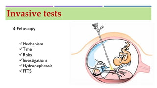 Prenatal diagnosis test | PDF