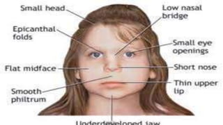 Prenatal influence on facial development | PPT