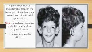Prenatal influence on facial development | PPTX