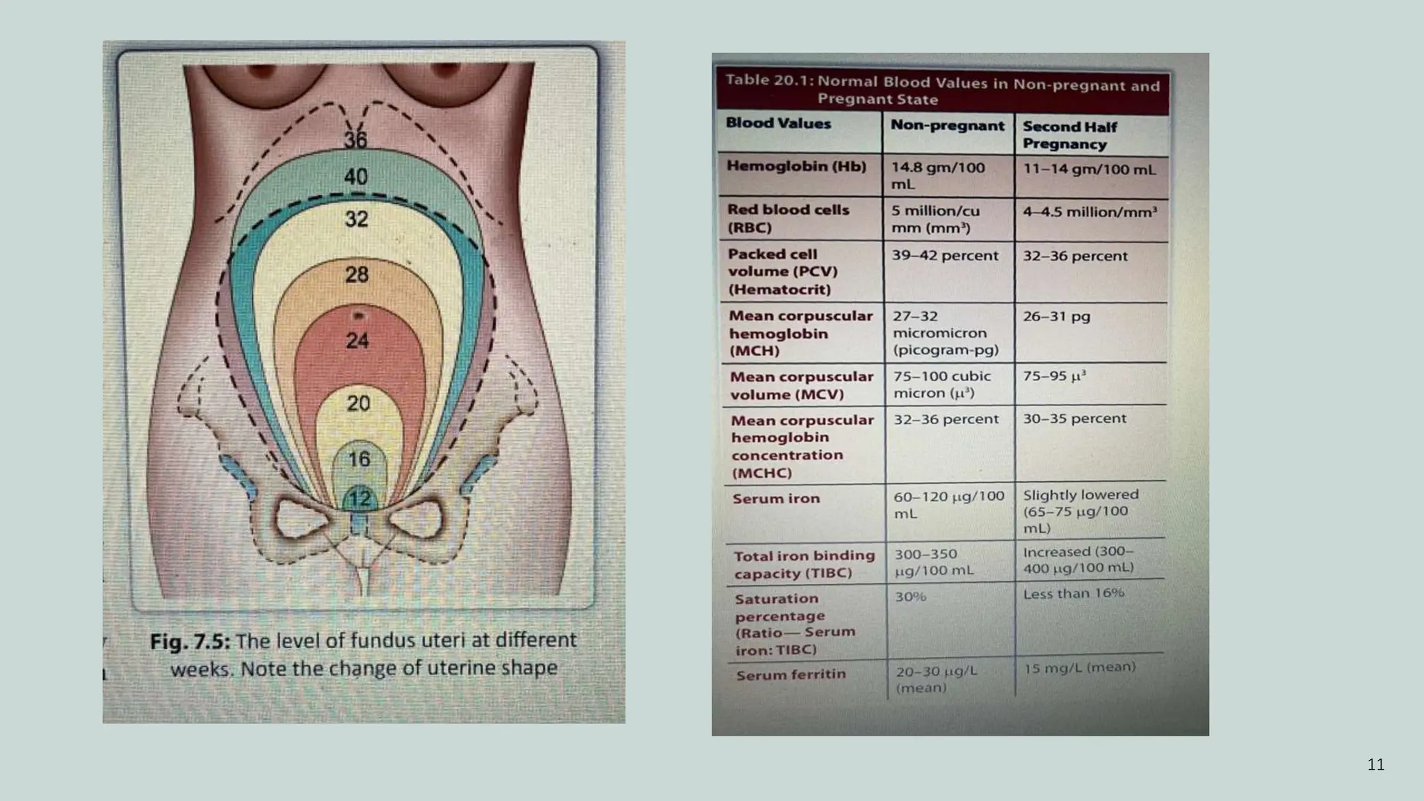 PRENATAL PHYSIOTHERAPY / antenatal pt management | PPTX