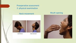 PRE OP pre operative assessment before surgery | PPTX