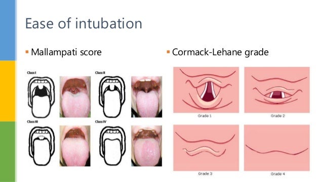 Preop and postop assessment