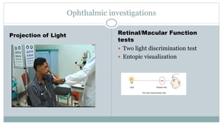 Pre-Op Assessment of Cataract | PPTX