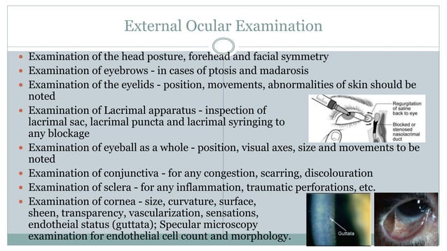 Pre-Op Assessment of Cataract | PPTX