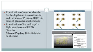 Pre-Op Assessment of Cataract | PPTX