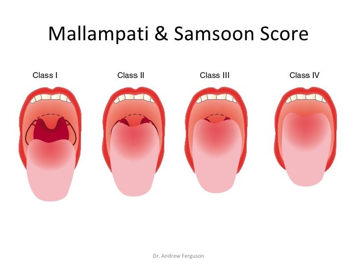 Preoperative Assessment (Intro)