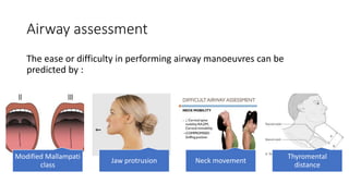 Pre-operative assessment (investigations) | PPTX
