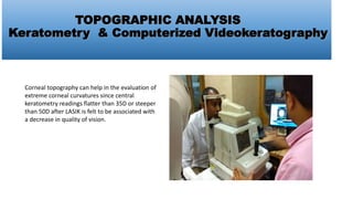 Pre op corneal laser | PPT