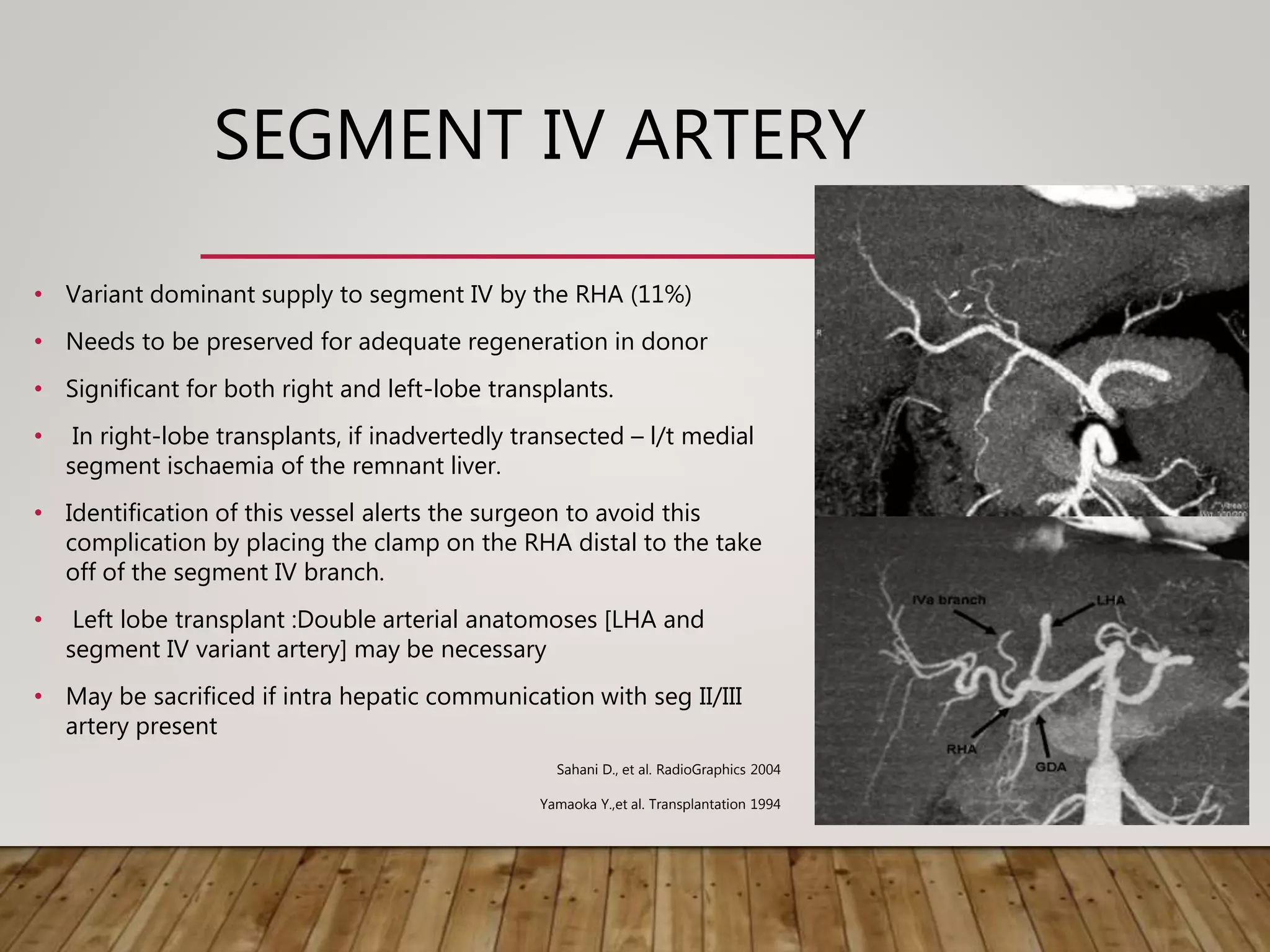 PREOPERATIVE DONOR WORKUP FOR LDLT | PPTX