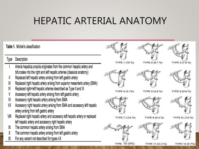 PREOPERATIVE DONOR WORKUP FOR LDLT | PPTX