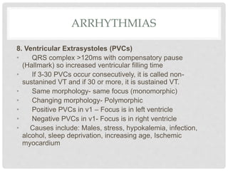 Perioperative EKG in Cardiothoracic Anesthesia | PPTX