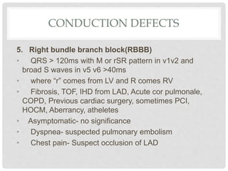 Perioperative EKG in Cardiothoracic Anesthesia | PPTX