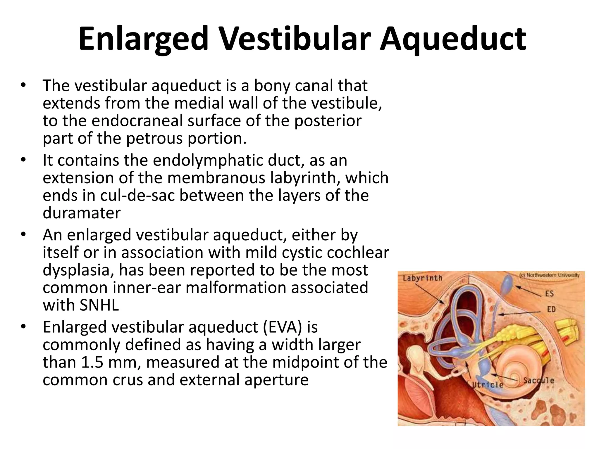 Preoperative assesment in cochlear implantation | PPTX