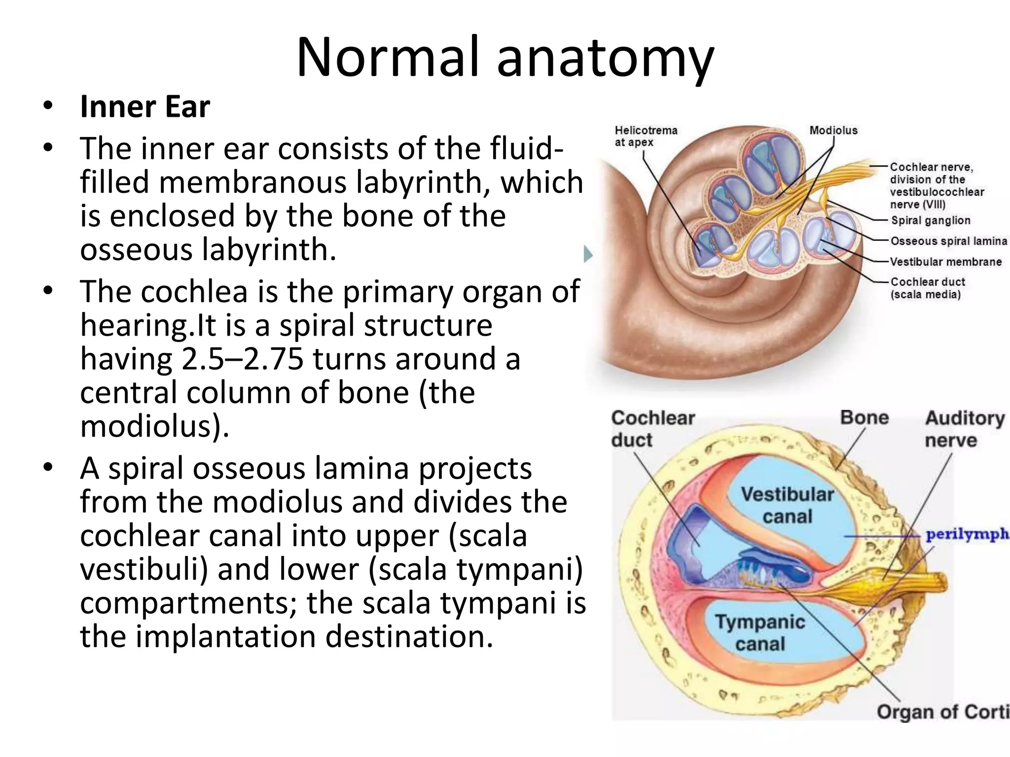 Preoperative assesment in cochlear implantation | PPTX