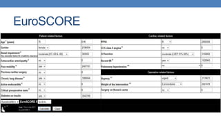 Preoperative Assessment of Coronary Artery Bypass Graft Patients | PPTX