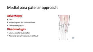 Preoperative assessment , surgical approaches , indications and ...