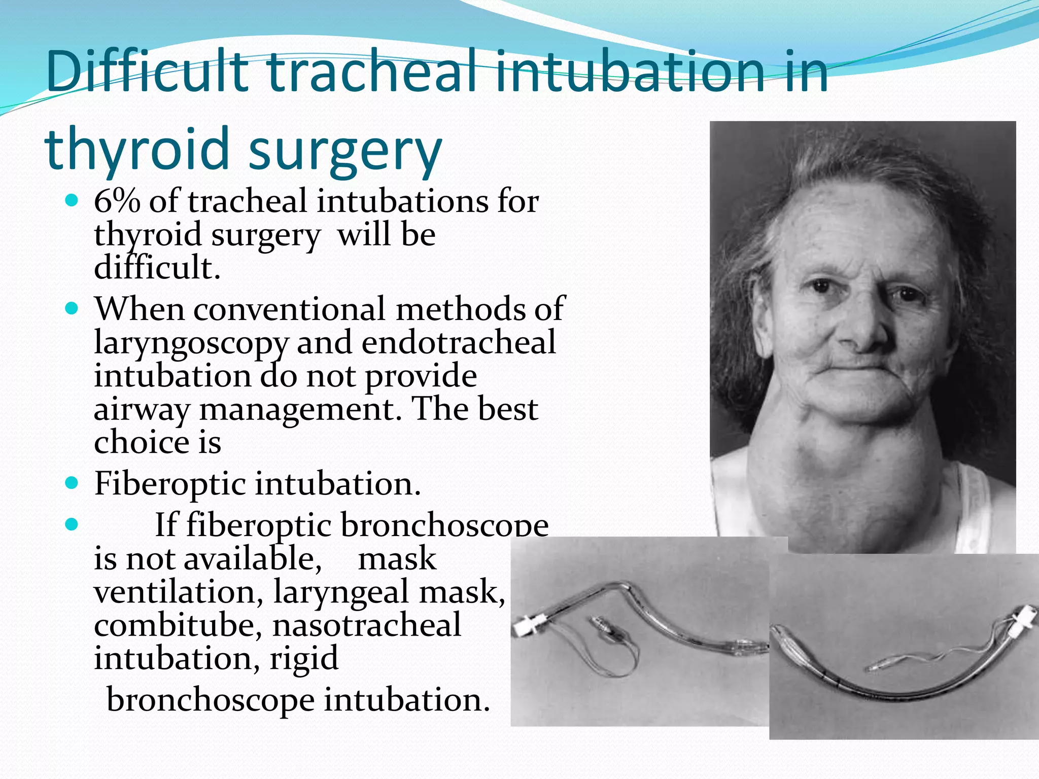 Preoperative management of hyperthyroidism in a goiterous patient | PPTX