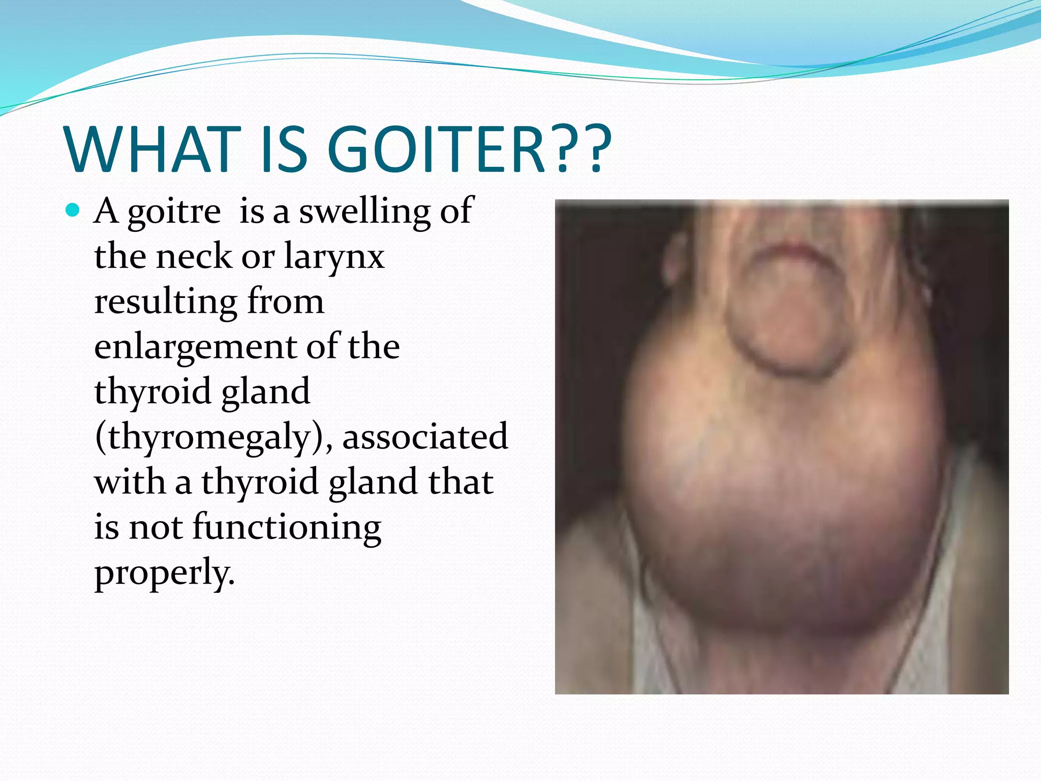 Preoperative management of hyperthyroidism in a goiterous patient | PPTX