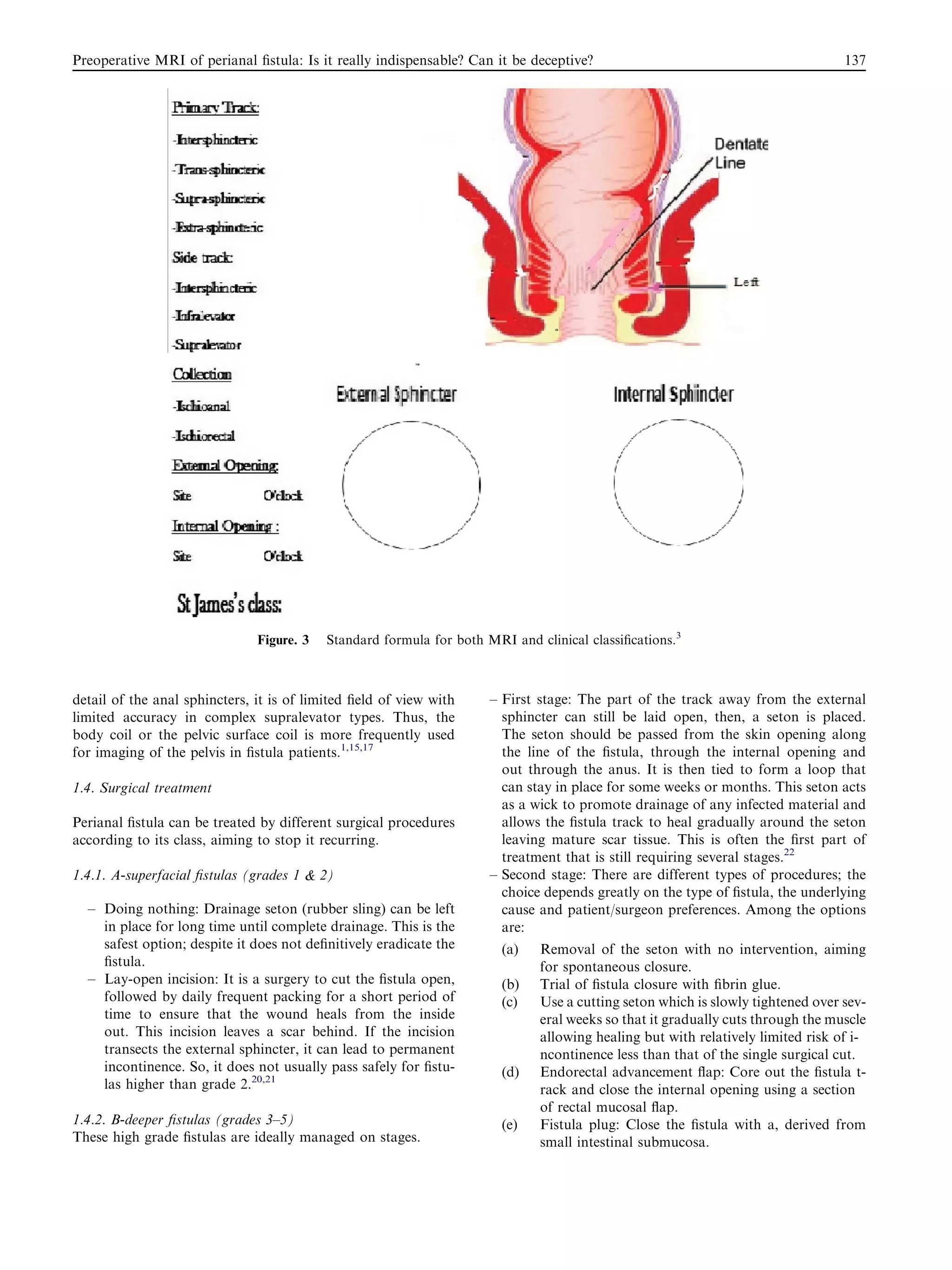 Preoperative mri of perianal fistula | PDF