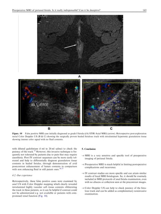 Preoperative mri of perianal fistula | PDF