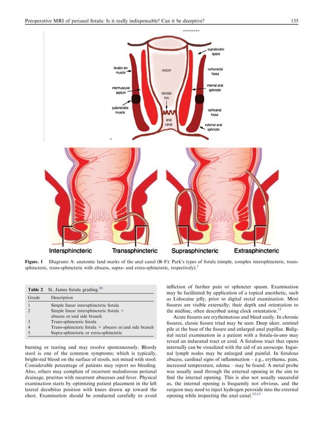 Preoperative mri of perianal fistula | PDF