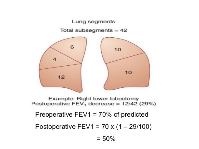 Preoperative optimization in thoracic surgery