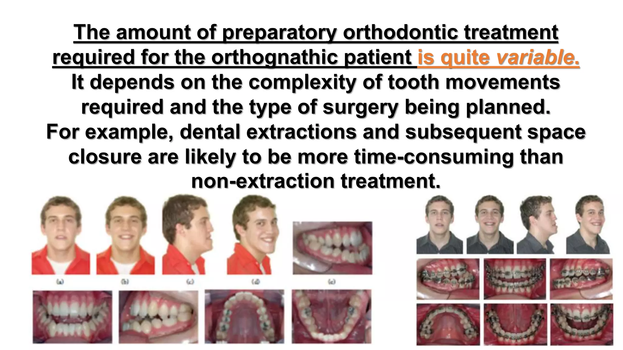 Preoperative orthodontics for orthognathic surgery | PPTX