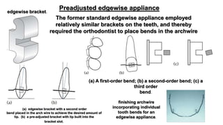 Preoperative orthodontics for orthognathic surgery | PPTX