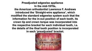 Preoperative orthodontics for orthognathic surgery | PPTX