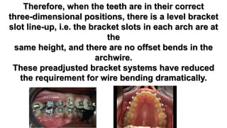 Preoperative orthodontics for orthognathic surgery | PPTX