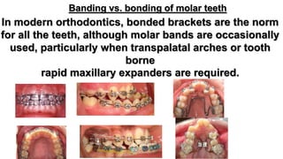 Preoperative orthodontics for orthognathic surgery | PPTX