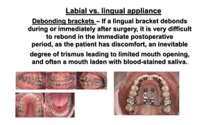 Preoperative orthodontics for orthognathic surgery | PPTX