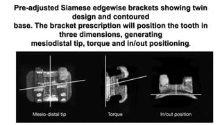 Preoperative orthodontics for orthognathic surgery | PPT