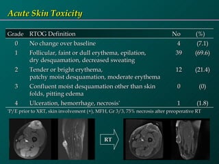 Preoperative Radiotherapy In Extremity Soft Tissue Sarcoma | PPT